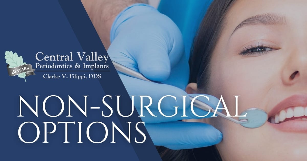 Non-Surgical Options — Modesto, CA — Clarke V. Filippi, DDS